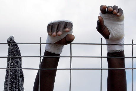 Injured Hands African Immigrant Raised Above Editorial Stock Photo ...