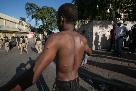 Demonstrator Shows His Injuries Rubber Bullets Editorial Stock Photo ...