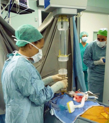 Undated Image Windpipe Transplant Stem Cells Editorial Stock Photo ...