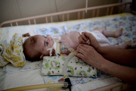 Eightmonthold Evgeny Who Suffers Cerebral Palsy Editorial Stock Photo ...