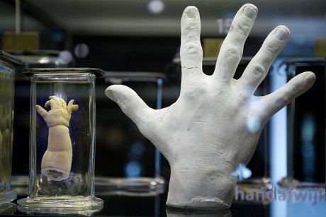View Hands Newly Renovated Museum Vrolik Editorial Stock Photo - Stock ...