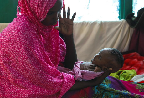 Fourmonthold Severely Malnourished Somali Baby Boy Editorial Stock ...