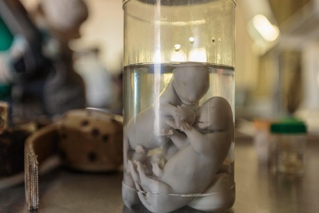 29 Animal fetus Stock Pictures, Editorial Images and Stock Photos ...