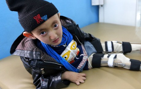 250 Handicapped boy Stock Pictures, Editorial Images and Stock Photos ...