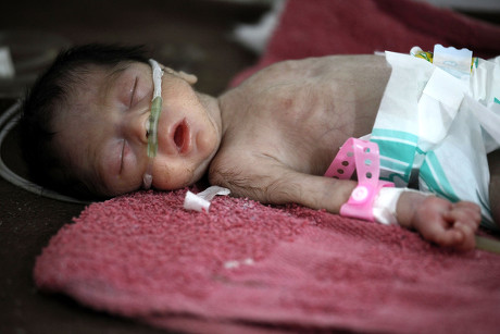 Infant Receives Medical Treatment Hospital Peshawar Editorial Stock ...