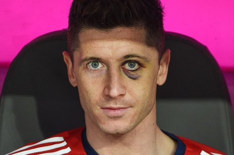 Mit Blauem Auge Robert Lewandowski Fc Editorial Stock Photo - Stock ...