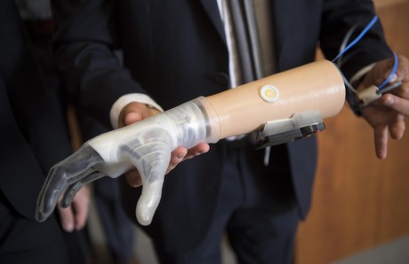 One Prototypes Polyarticulate Prosthetic Hand Hannes Editorial Stock ...