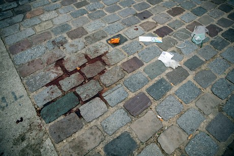 Blood Stains Medical Equipment Seen Scene Editorial Stock Photo - Stock ...
