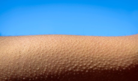 2,000 Goosebumps Stock Pictures, Editorial Images and Stock Photos ...