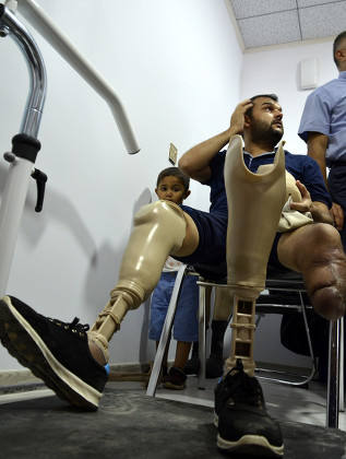 Iraqi Man Who Lost His Legs Editorial Stock Photo - Stock Image ...