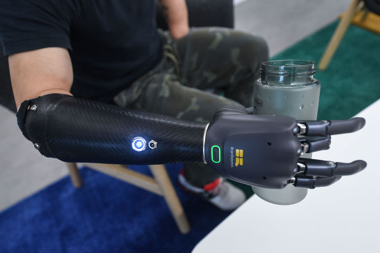 Amputated Man Uses Brainrobotics Smart Prosthetic Editorial Stock Photo ...