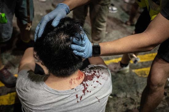 Man Bleeding Being Helped During Protest Editorial Stock Photo - Stock ...