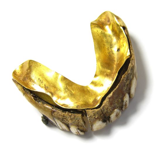 Gold Dentures Editorial Stock Photo - Stock Image | Shutterstock