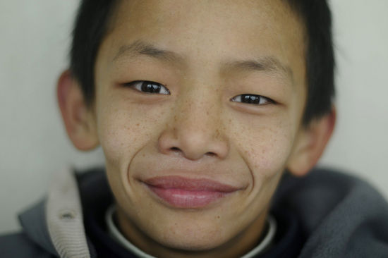 Hiv Infected Child School Editorial Stock Photo - Stock Image ...