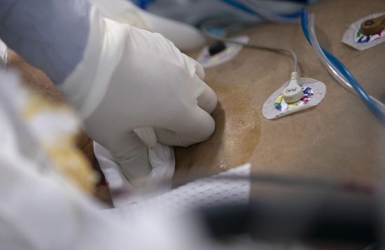 Medical Staff Press Wound Prevent Bleeding Editorial Stock Photo ...