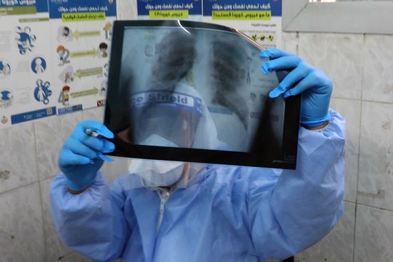Medical Personnel Checks Xray Imbaba Fevers Editorial Stock Photo ...