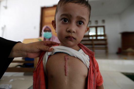 Boy Scar Heart Surgery Has His Editorial Stock Photo - Stock Image ...