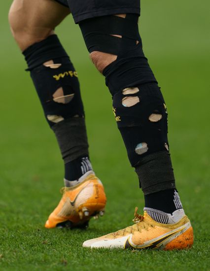 Ripped Socks Worn By Kiko Watford Editorial Stock Photo - Stock Image ...