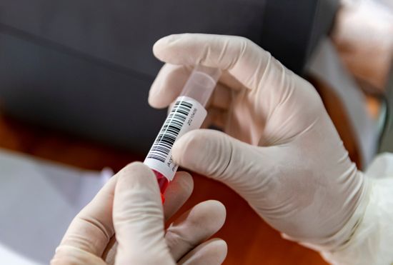 Medical Worker Attaches Bar Code Tag Editorial Stock Photo - Stock ...