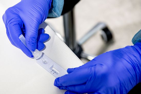 People Get Tested Test Street Access Editorial Stock Photo - Stock ...