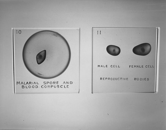 View Malarial Cells Spore Blood Corpuscle Editorial Stock Photo - Stock ...