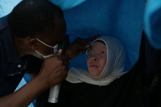 Woman Suffering Albinism Receives Eye Examination Editorial Stock Photo ...
