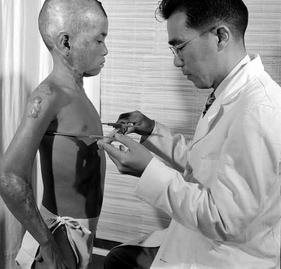 Unidentified Member Atomic Bomb Casualty Commission Editorial Stock ...