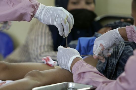 Doctors Perform Circumcision On Boy During Editorial Stock Photo ...