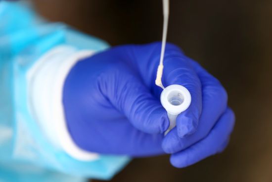 Medical Staff Take Pcr Test Coronavirus Editorial Stock Photo - Stock ...