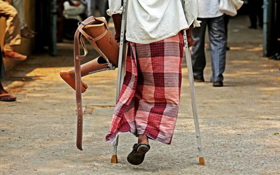 Physically Challenged Person Walks On Crutches Editorial Stock Photo ...