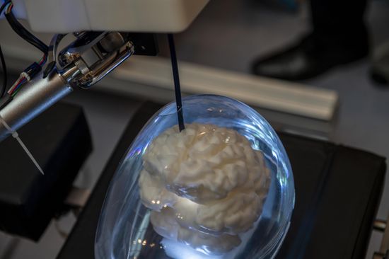 Microneuro Surgical Robotic System Develop By Editorial Stock Photo ...