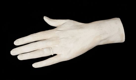 Cast Dianas Hand a Pair Incredible Editorial Stock Photo - Stock Image ...