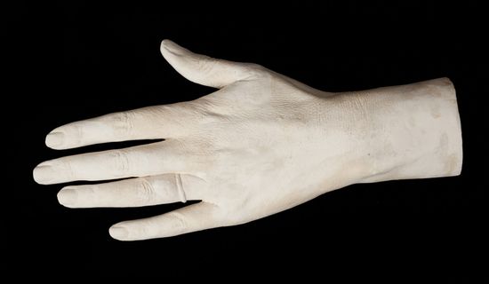 Cast Dianas Hand a Pair Incredible Editorial Stock Photo - Stock Image ...