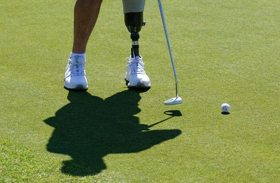 Single Leg Amputee Trevor Reich South Editorial Stock Photo - Stock ...