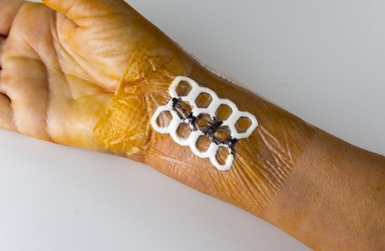 Postoperative Wound Dressing Honeycomb Wound Pad Editorial Stock Photo ...