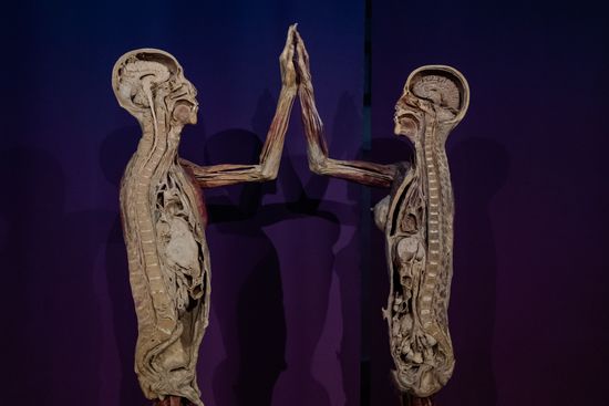 Two Dissected Human Bodies Real Bodies Editorial Stock Photo - Stock ...