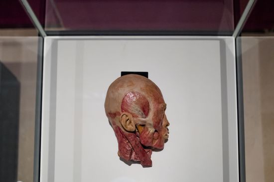 Detail Head Human Body Real Bodies Editorial Stock Photo - Stock Image ...