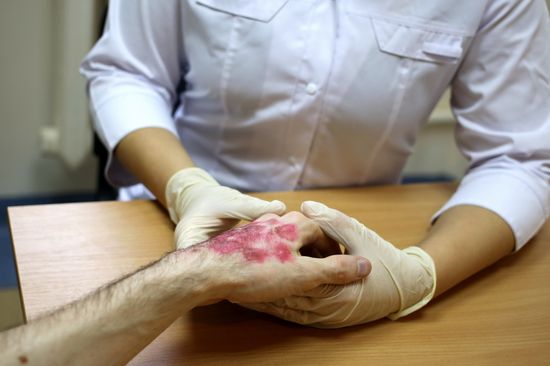 Student Seen Examining Rash On Patients Editorial Stock Photo - Stock ...