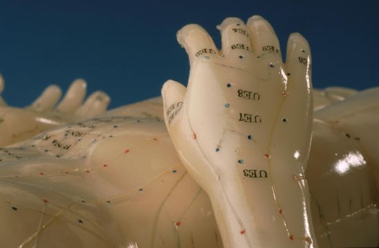 Acupuncture Acupuncture Points Human Body Shown Editorial Stock Photo ...