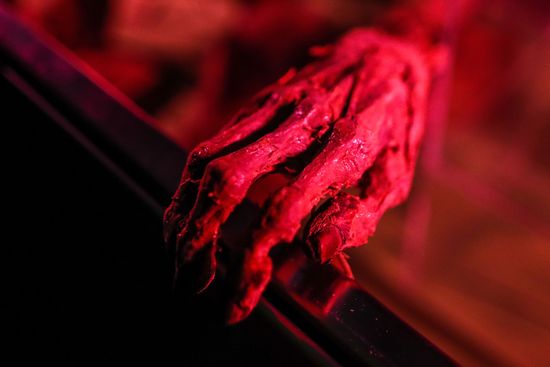 Close Human Hand Cadaver Donor During Editorial Stock Photo - Stock ...