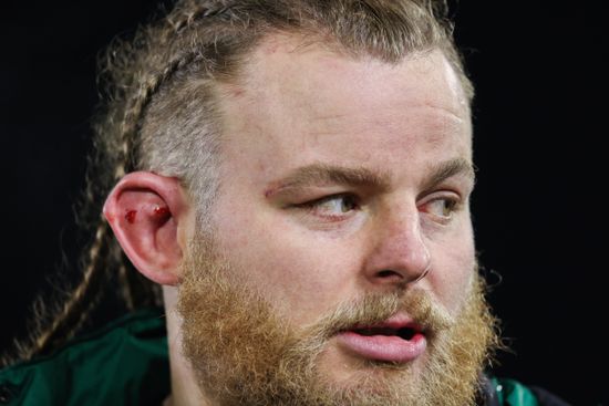 Newcastle Falcons Vs Connacht Connachts Finlay Editorial Stock Photo ...