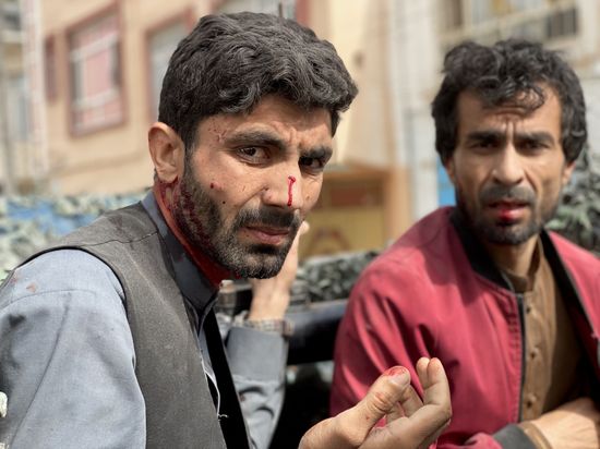 Injured Journalists Leave Scene Blast Cultural Editorial Stock Photo ...