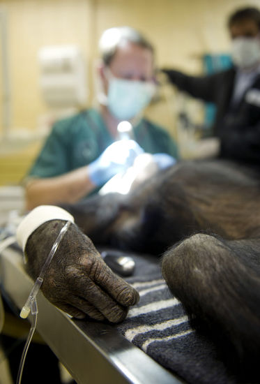 4yearold Chimp Fiona During Surgery Editorial Stock Photo - Stock Image ...