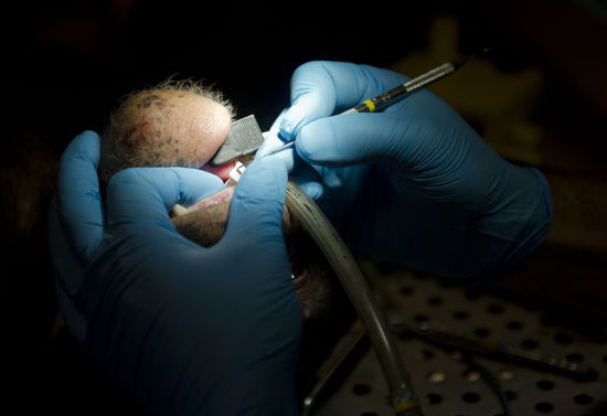 4yearold Chimp Fiona During Surgery Editorial Stock Photo - Stock Image ...