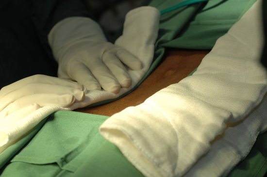 Patient Prepared Laparotomy Editorial Stock Photo - Stock Image ...