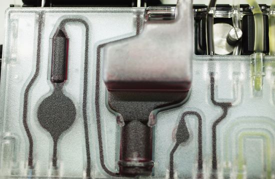 Trima Accel Automated Blood Collection System Editorial Stock Photo ...