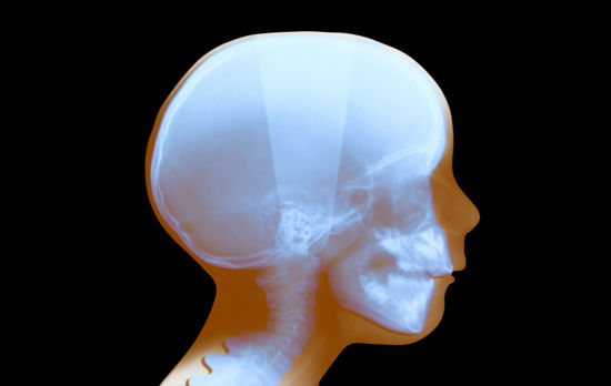 Retrogenia Chin Editorial Stock Photo - Stock Image | Shutterstock