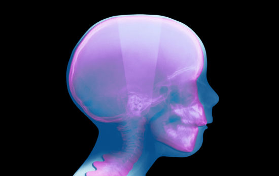Retrogenia Chin Editorial Stock Photo - Stock Image | Shutterstock