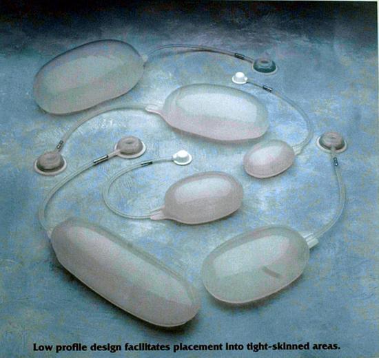 Tissue Expanders Traditionally Used Plastic Surgery Editorial Stock ...