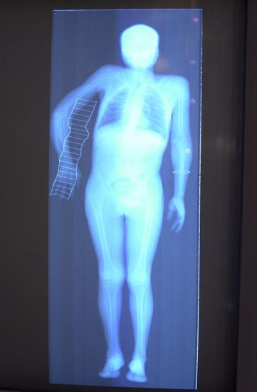 Full Body Xray Machine Editorial Stock Photo - Stock Image | Shutterstock